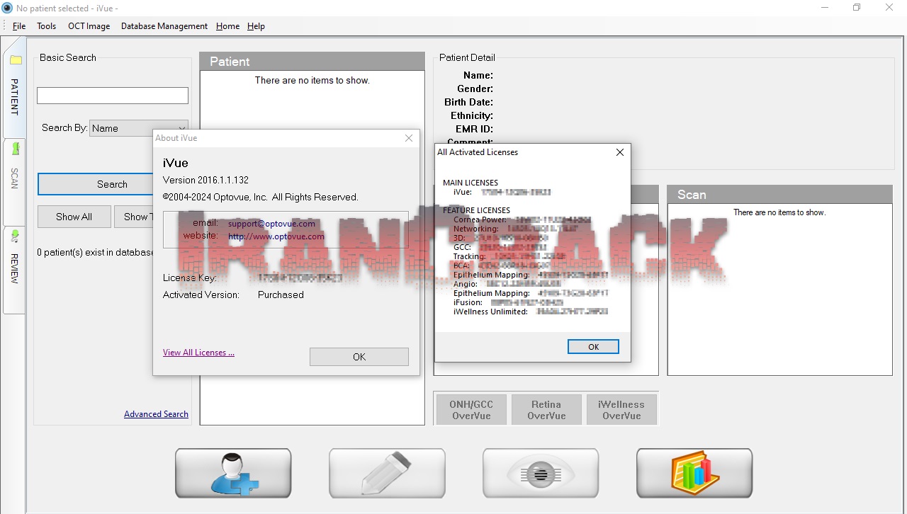 نرم افزار تصویر برداری شبکیه چشم Optovue iVue 2016 | ایران کرک