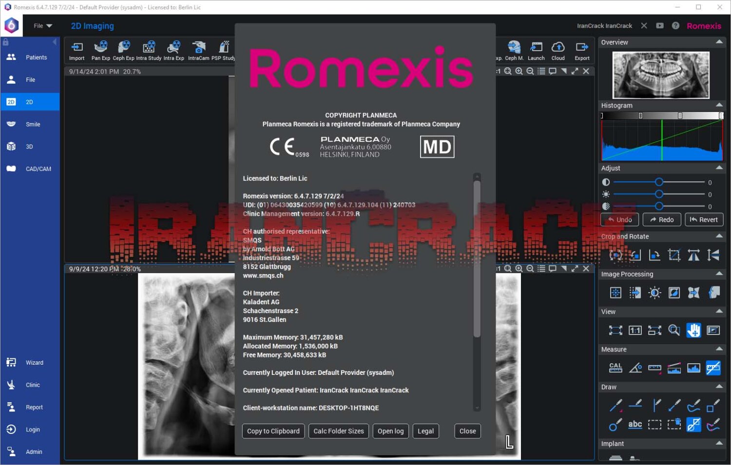 نرم افزار دندانپزشکی Planmeca Romexis 2024 | ایران کرک